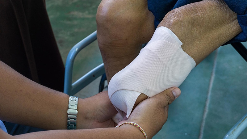 Fort Lauderdale Amputation Injury Attorney | 🏆 Top Rated